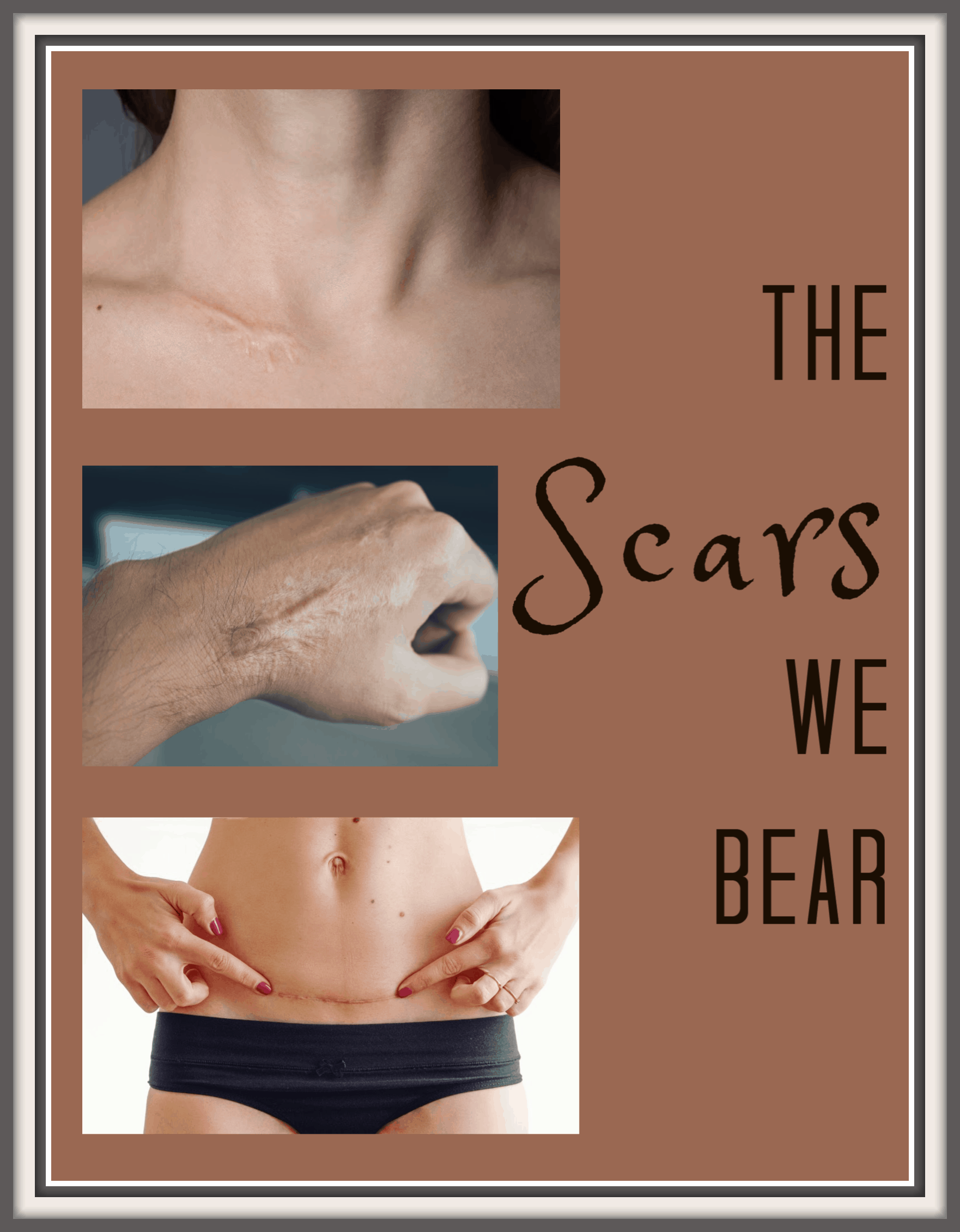 The Scars We Bear - Everyday Living - Sarah's Peonies